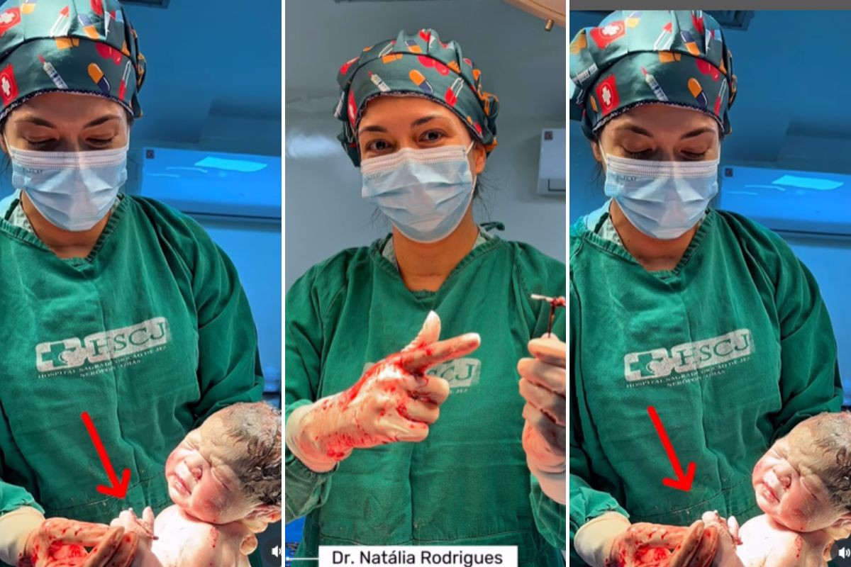 Bebê nasce com DIU na mão após falha no método contraceptivo